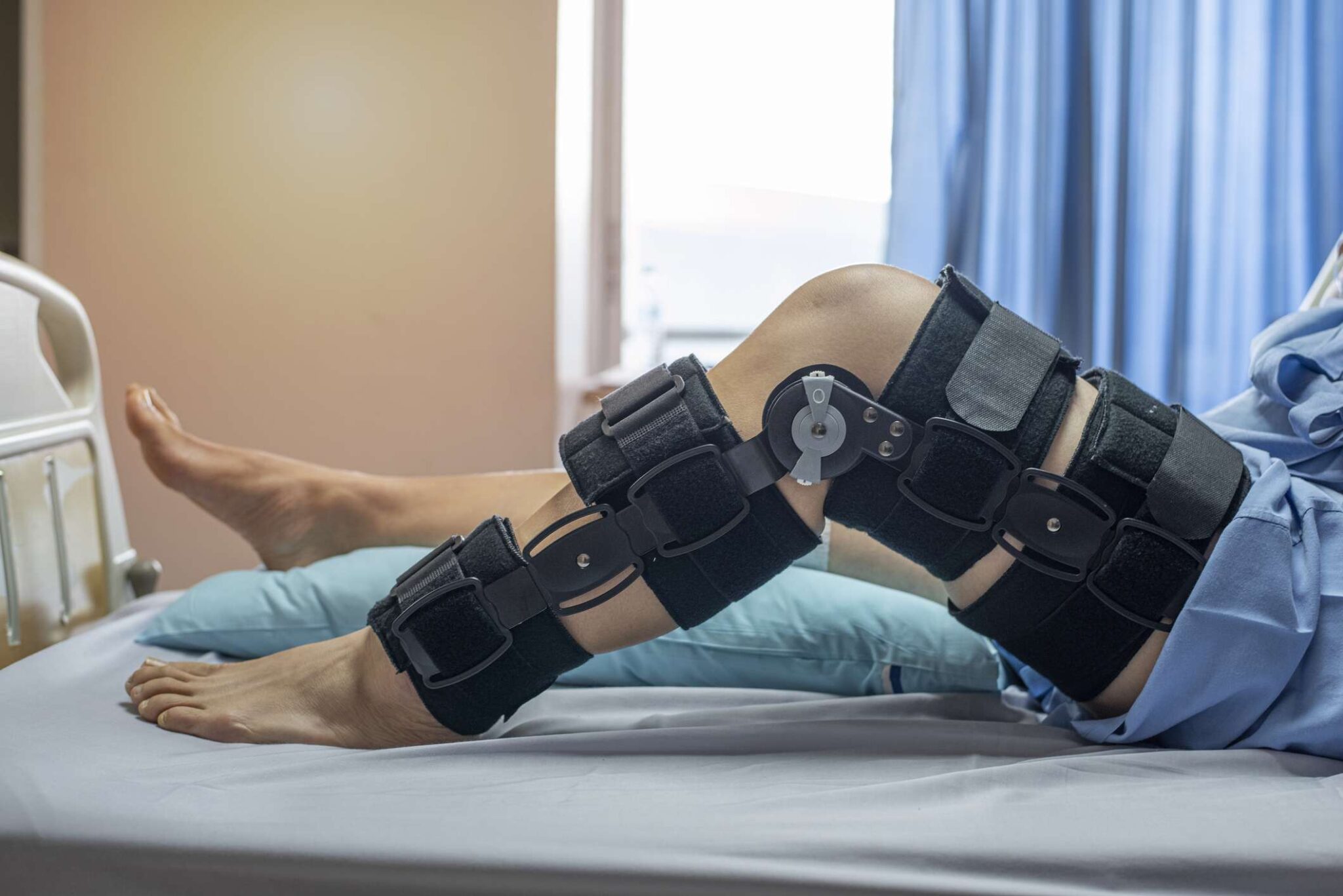 Setting Smart Goals for Acl Reconstruction Recovery: a Physiotherapist ...