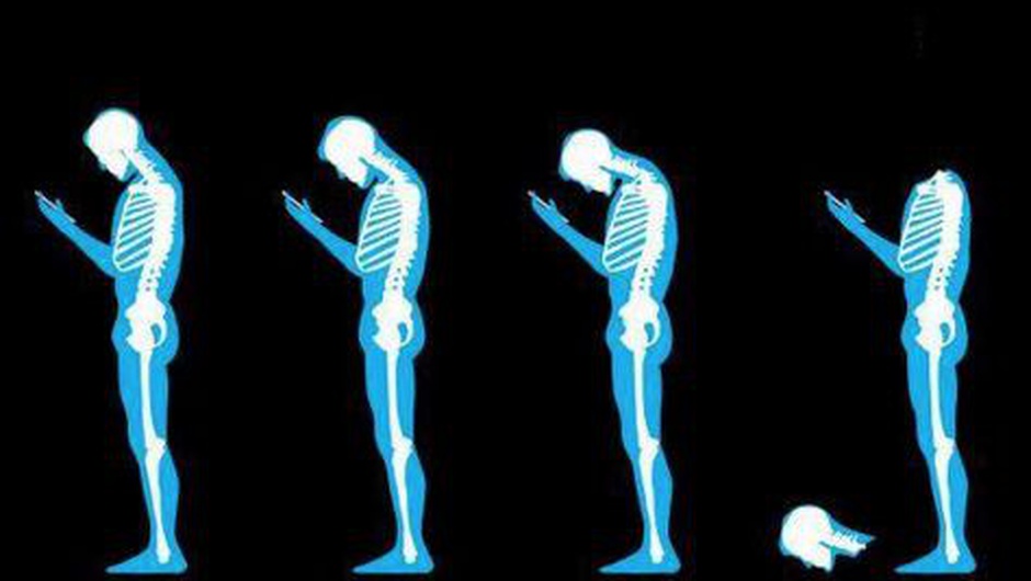 is Your Mobile Phone Giving You a Pain in the Neck? Learn How to Avoid It